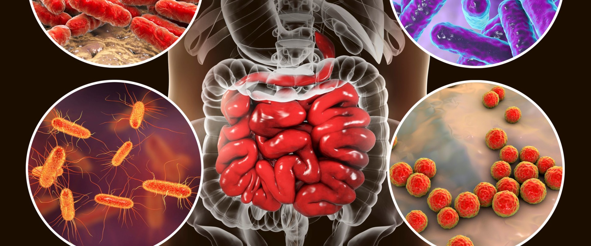 The Importance of Gut Bacteria in Digestive Health